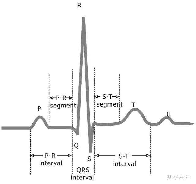 如何评价华为发布 WATCH GT 2 Pro 及其 ECG 心电图款？有哪些亮点和不足？ - 知乎