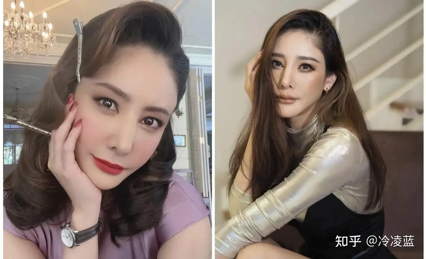 Noey Chotika Before Surgery