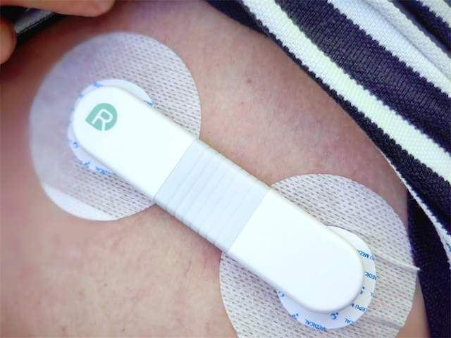 别犯傻，心血管病才是父母健康最大的威胁，附乐普ER1 24小时动态心电记录仪深度评测 - 知乎