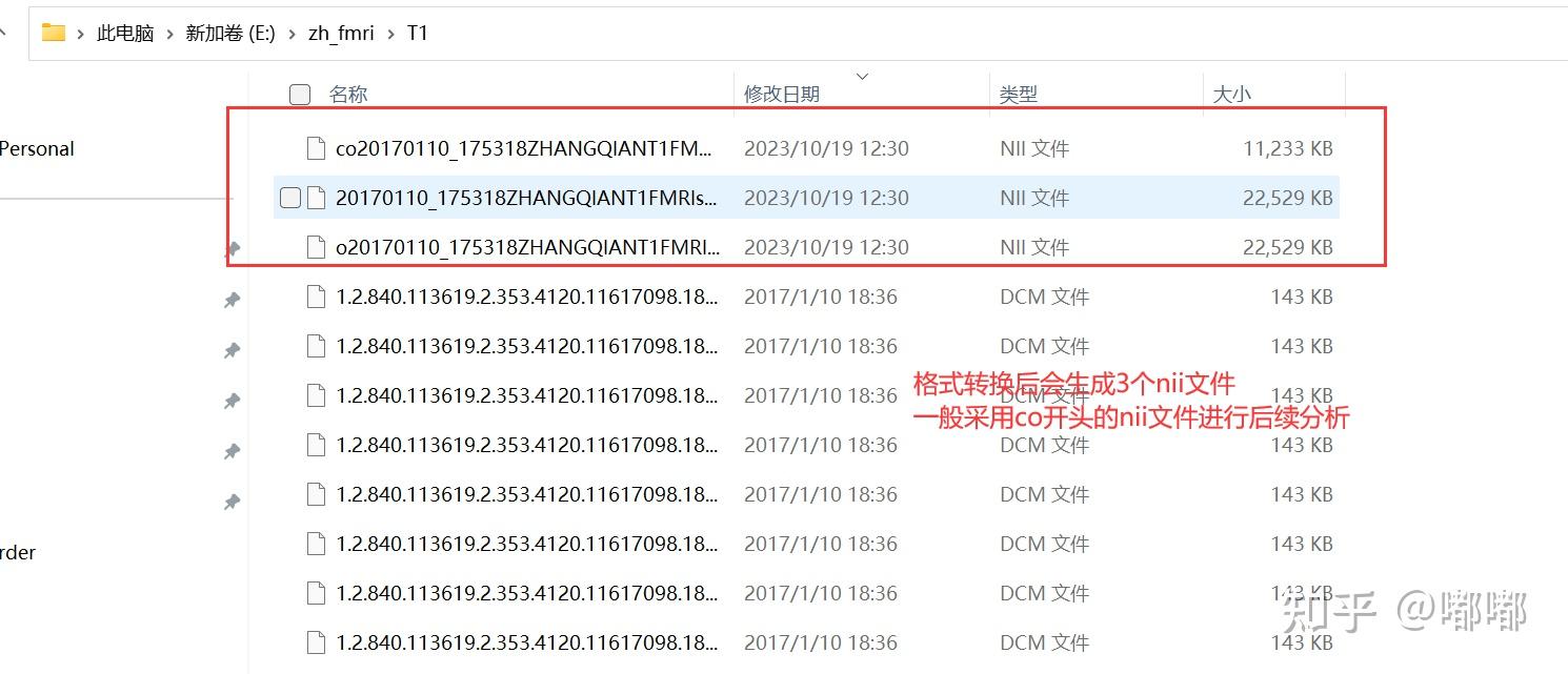 1-spm-fMRI任务态数据处理——格式转换 - 知乎