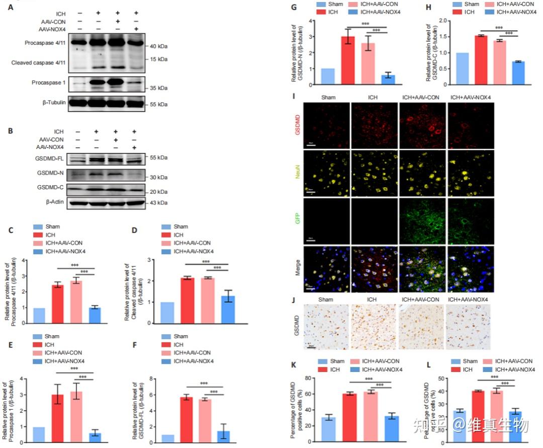 脑出血治疗新靶点！敲低NOX4可减轻ICH后的线粒体氧化应激和神经元焦亡 - 知乎