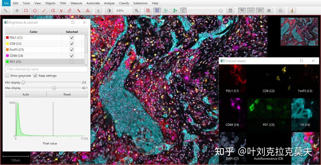 开源科学工程技术软件介绍 – 生物图像分析软件QuPath - 知乎