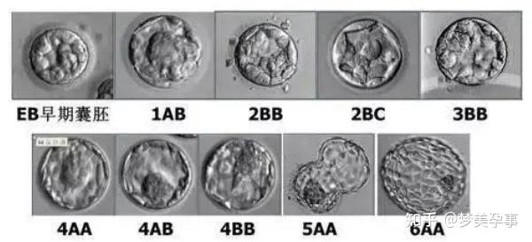 4AB的囊胚可以移植吗?赴美做试管成功几率有多少呢? - 知乎
