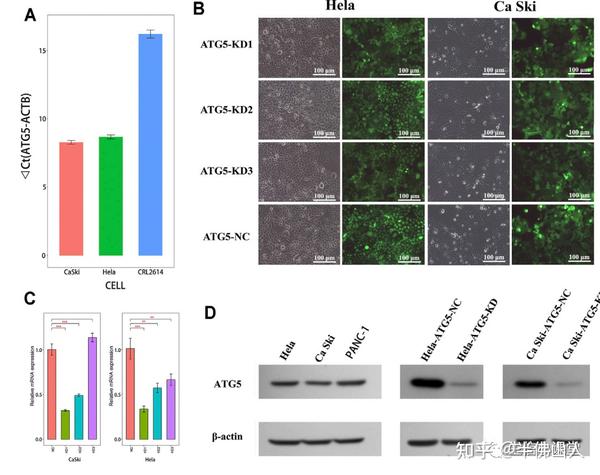 6.6分SCI，单基因单肿瘤+实验验证经典思路 - 知乎