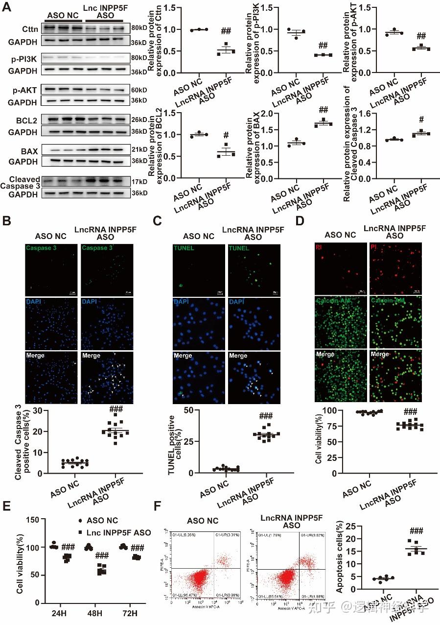 CNSNT︱上海大学杜东书团队发现：延髓头端腹外侧区lncRNA INPP5F通过miR-335/Cttn轴调控应激性高血压机制 - 知乎