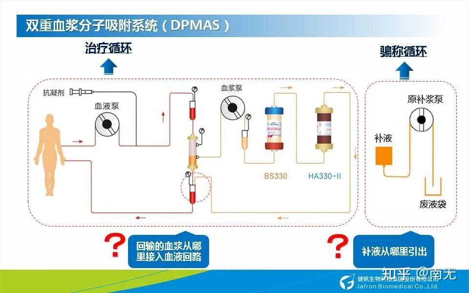 护理DPMAS冲管流程 - 知乎
