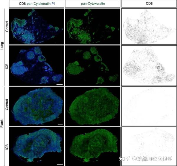 Science子刊|TissueFAXS Cytometery技术&新型细胞因子疗法为肿瘤免疫治疗带来希望 - 知乎