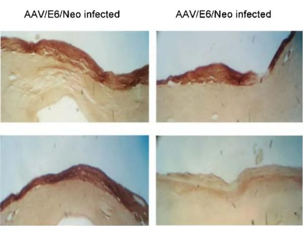 【科研实用宝典】AAV在皮肤组织研究中的应用总结 - 知乎
