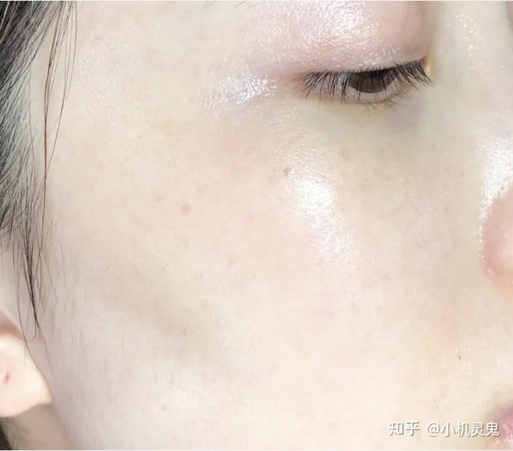 有什么坚持做能让皮肤变好的小习惯 知乎