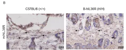 罕见型银屑病治疗新时代，靶向IL-36R研究已就位 - 知乎