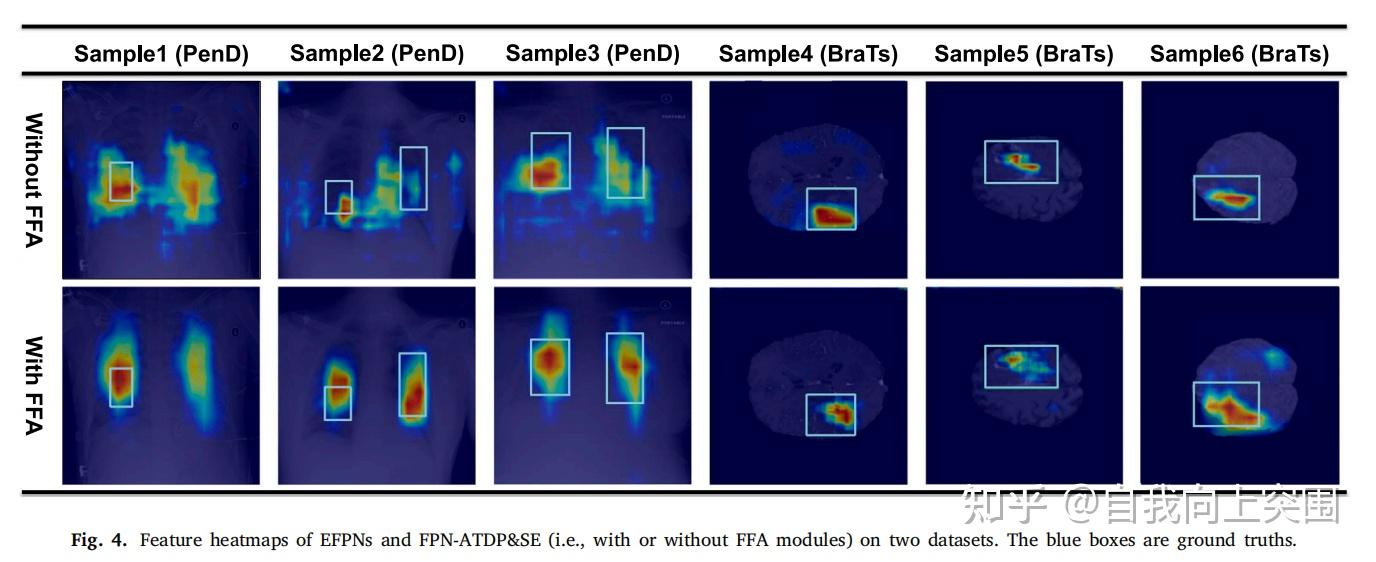 EFPN: Effective medical image detection using feature pyramid fusion ...
