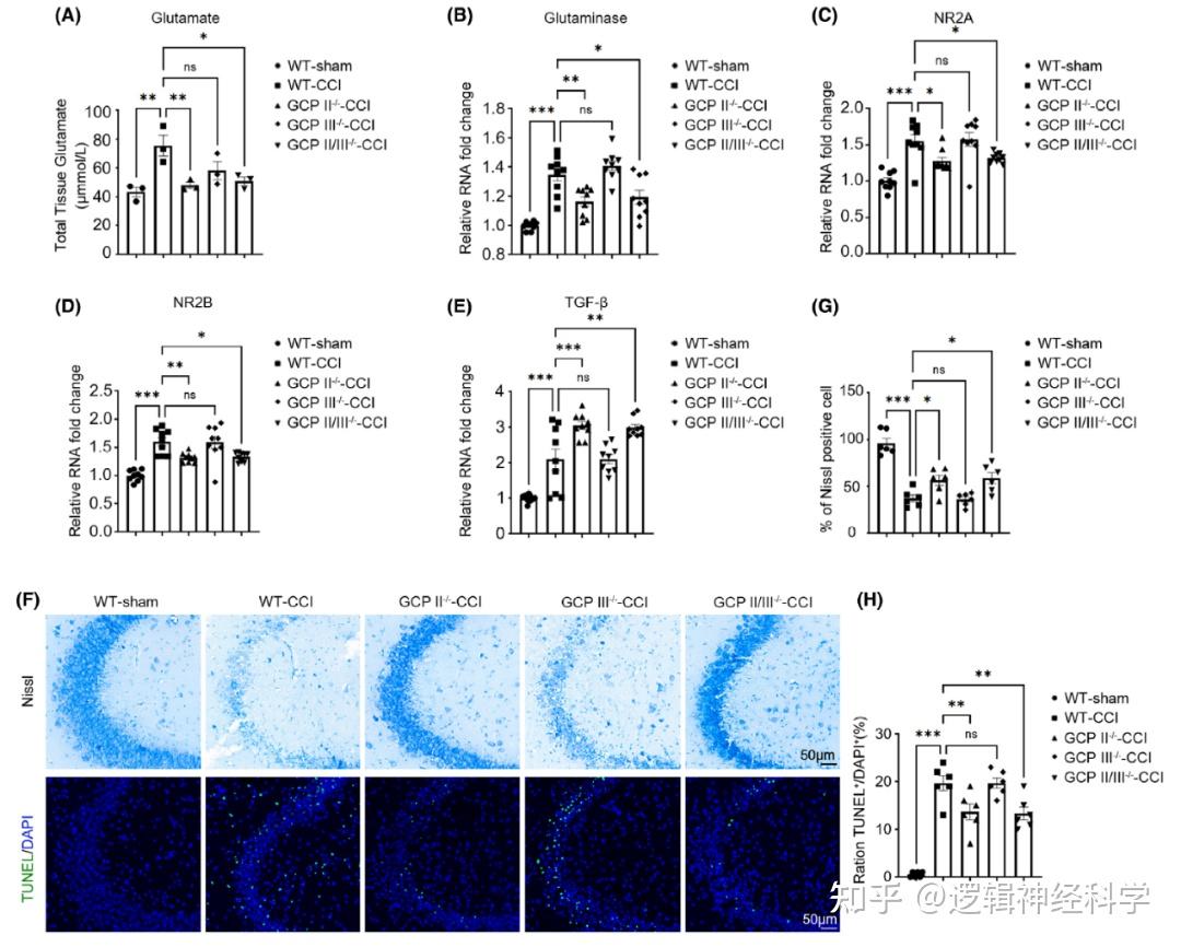 CNSNT︱同济大学钟春龙团队揭示NAAG肽酶GCPII及其同源物GCPIII在创伤性脑损伤中的功能关系 - 知乎