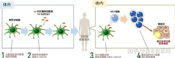 最新消息：日本濑田诊所集团即将开展新型细胞疗法 首家采用NKT细胞疗法 +DC疫苗联合方案 - 知乎