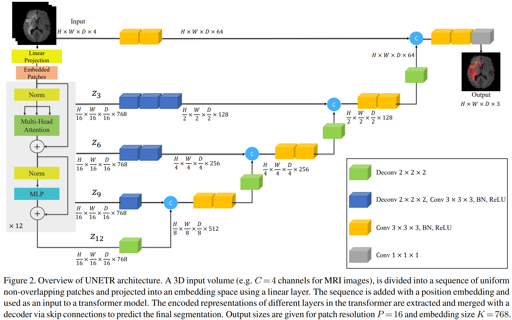 【WACV 2022】UNETR：用于 3D 医学图像分割的Transformer（research-contributions） - 知乎