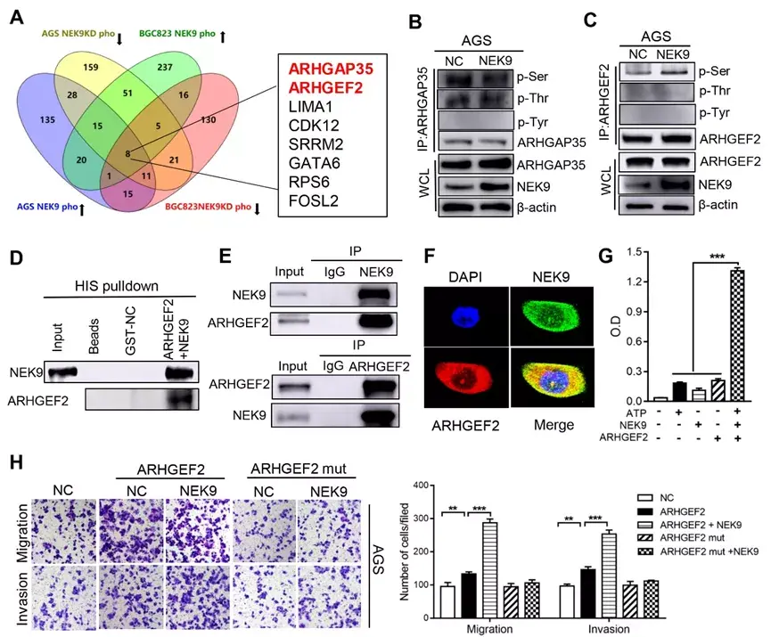 Theranostics:空军军医大学第一附属医院团队揭示NEK9在细胞骨架及胃癌转移中作用和机制 - 知乎