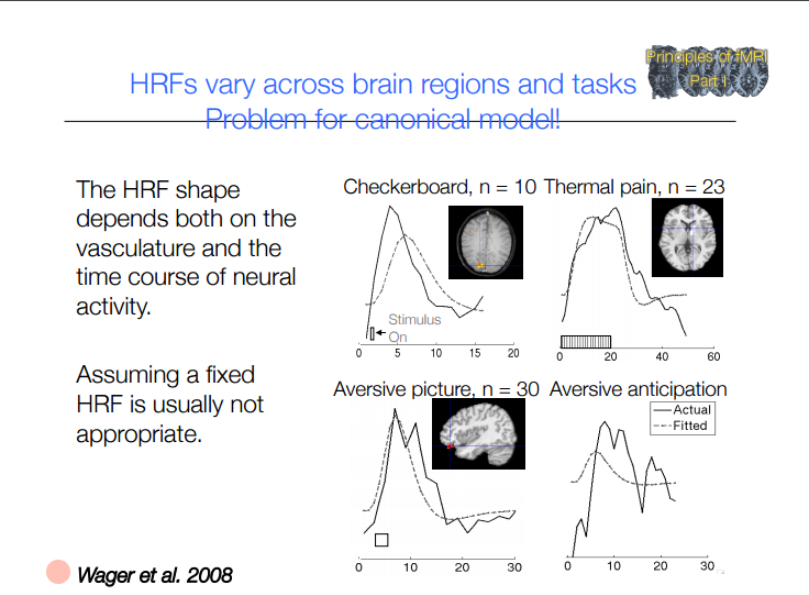 【fMRI Note】Module18 一般线性模型构建2 用线性基组进行灵活的血液动力学建模 - 知乎