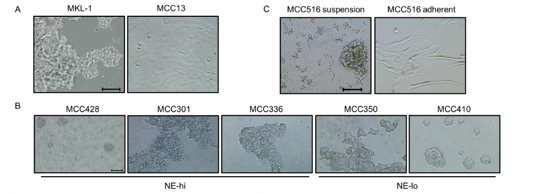 单细胞技术揭示默克尔细胞癌YAP1和WWTR1表达特异性 - 知乎