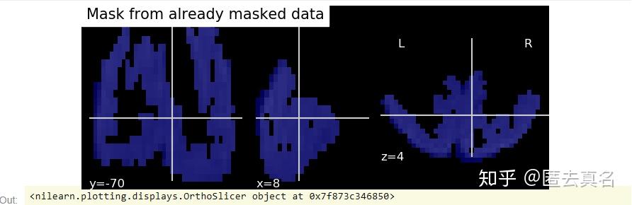 nilearn 笔记（16） - 知乎