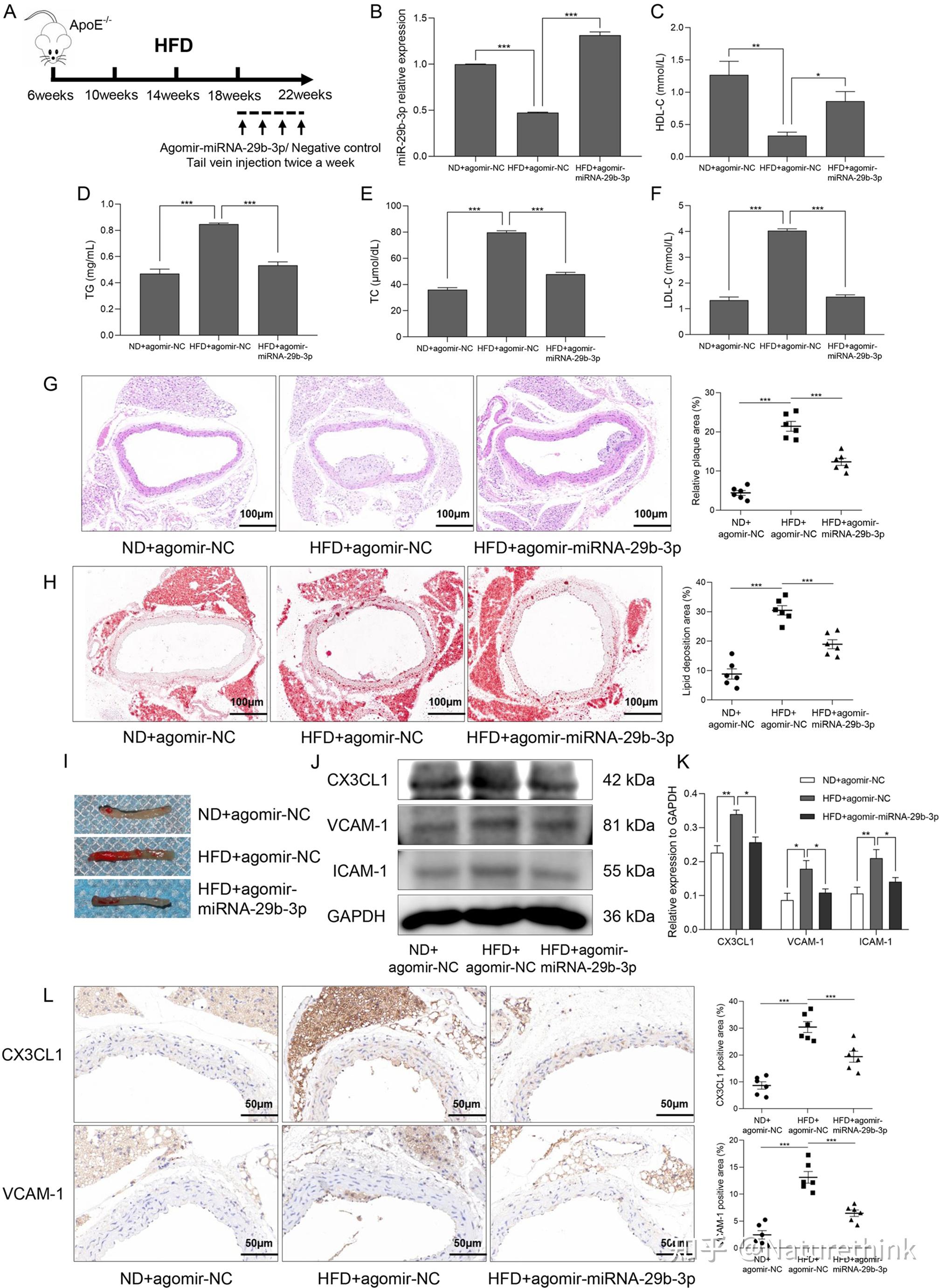 层流剪切应力通过 miR-29b-3p/CX3CL1 轴调控减轻单核细胞粘附和动脉粥样硬化的发展 - 知乎