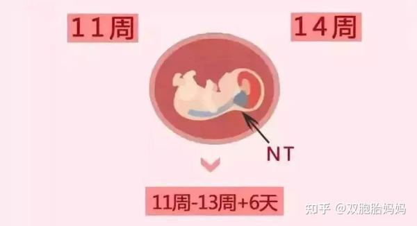 掌握基本功！一看就懂的NT测量常用解读方法，图文并茂 - 知乎