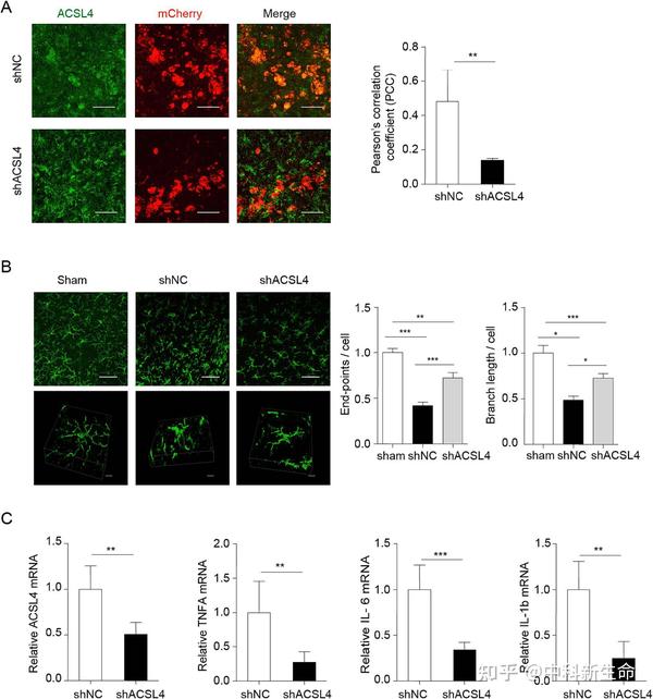 项目文章Brain Behav Immun (IF 19.227) |青岛大学崔玉课题组发现ACSL4促进神经炎症新机制 - 知乎