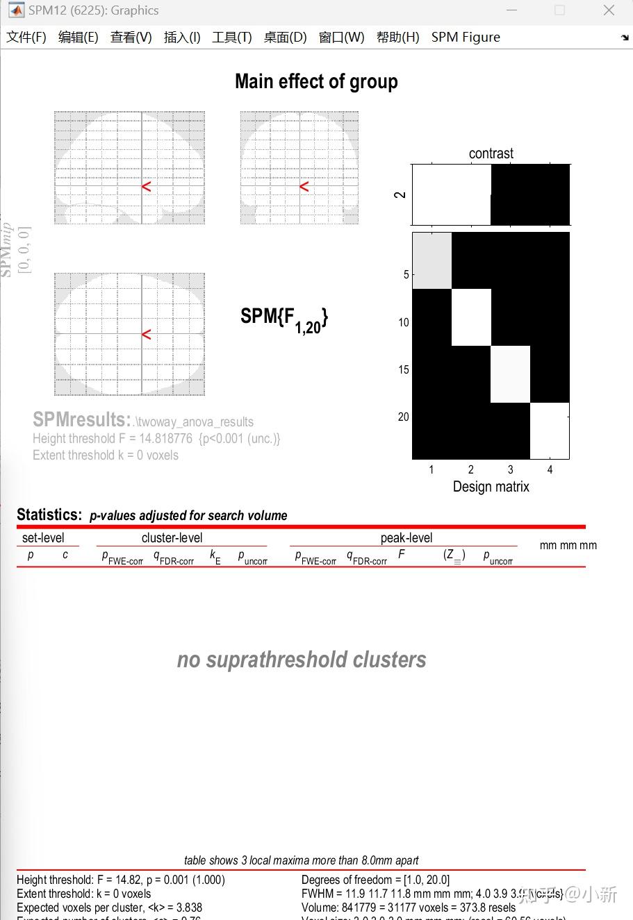 13-SPM-fmri任务态 二阶分析：多因素方差分析 - 知乎
