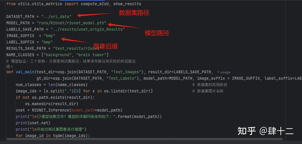 Unet系列模型在自己医学数据集上的使用（unet、unet++、r2net、attention unet以及unet的改进） - 知乎