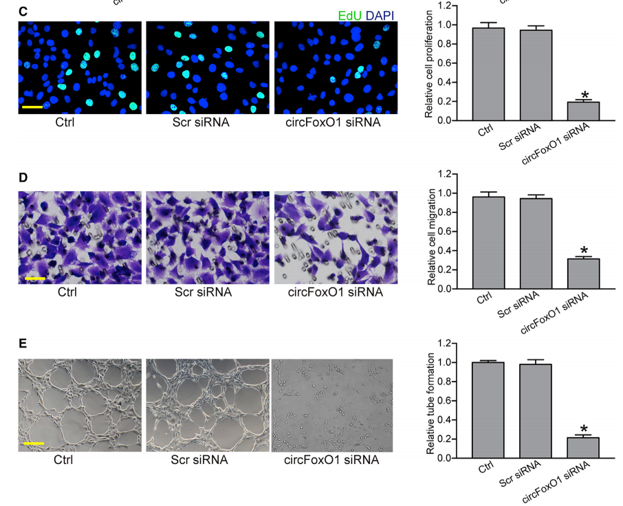 近视机制最新发现（2021.7）——环状RNA在近视进程中起关键作用 - 知乎