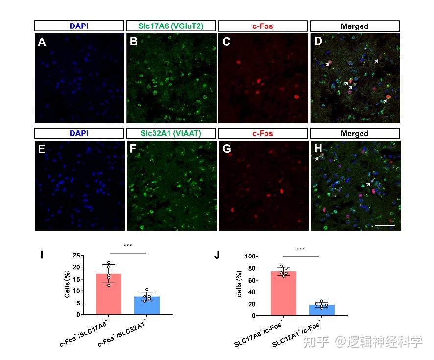 Neurobiol Dis︱郑州大学杨建军课题组揭示外侧下丘脑-外侧缰核神经环路在神经病理性疼痛中的重要作用 - 知乎