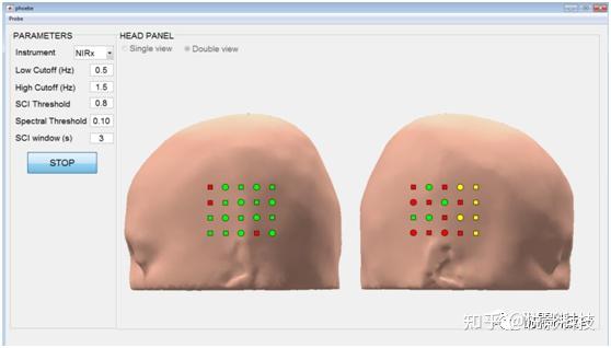 值得收藏！fNIRS功能近红外数据处理工具包盘点（全网最全） - 知乎