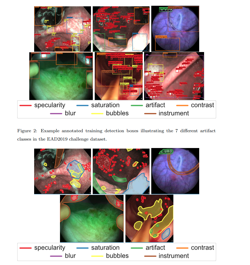 Endoscopy Artifact Detection (EAD 2019) 数据集介绍 - 知乎