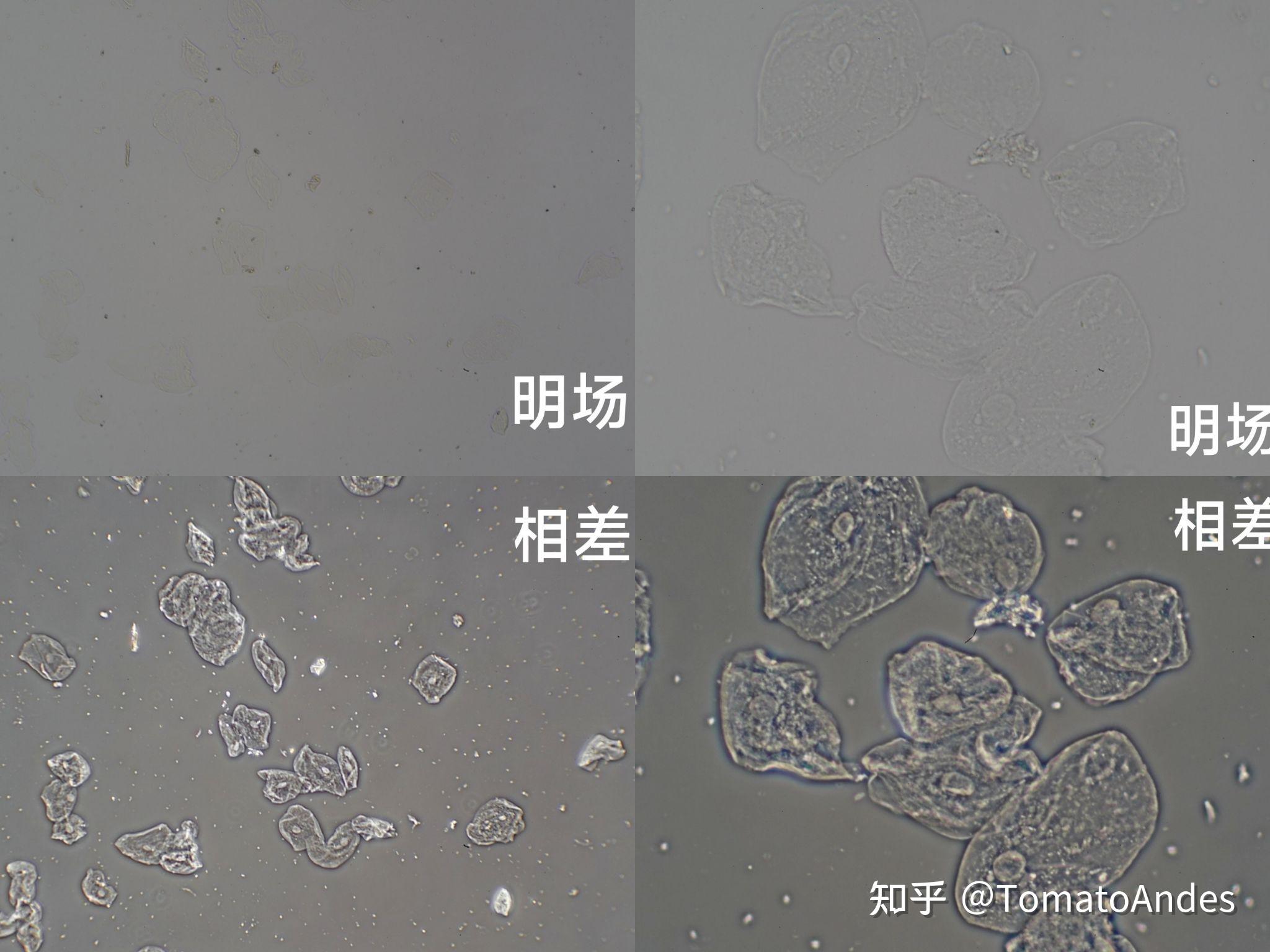 普通显微镜爱好者如何玩转显微镜（明场，暗场，斜射，偏光，莱茵，相差） - 知乎