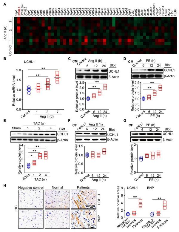 国自然热点——一篇10+文章的去泛素化酶的课题设计思路 - 知乎