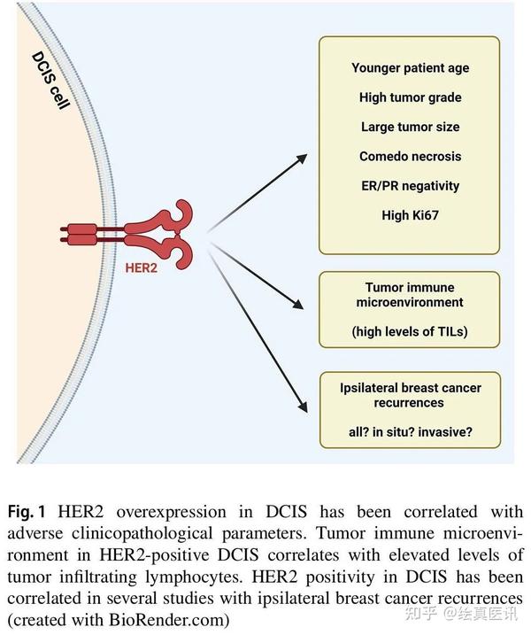 【综述】乳腺导管原位癌中HER2表达的临床意义 - 知乎