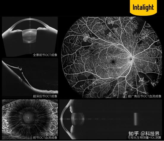 Intalight赛炜获超亿元D轮融资，并向图湃发起商业秘密侵权及专利权属诉讼 - 知乎