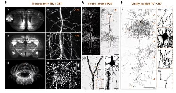 CSFT——全脑成像技术再迎革新 - 知乎
