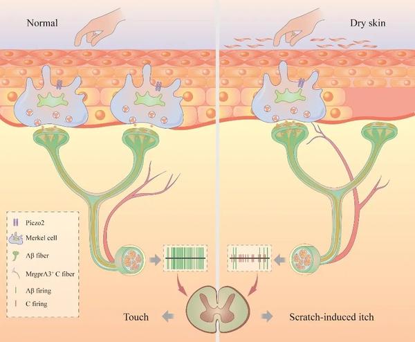 格索普插图丨越抓越痒？药物所封晶团队揭示“痒-抓循环”的外周机制 - 知乎