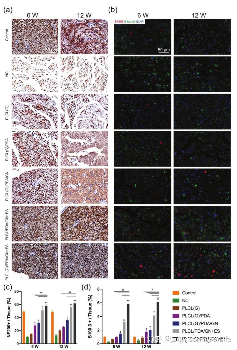 《Small Methods》：电刺激助力微图案化神经导管促进神经修复 - 知乎