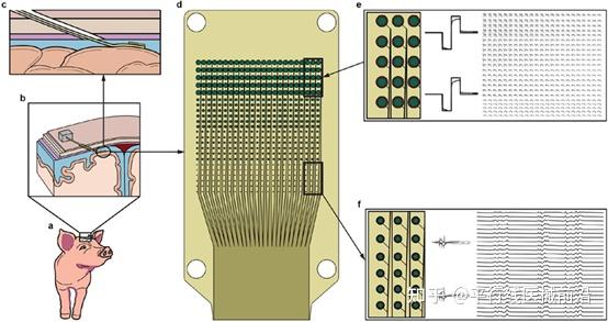 万字长文-侵入式脑机接口公司全面深度解析，BCI离解决真正临床问题还有多远？ - 知乎