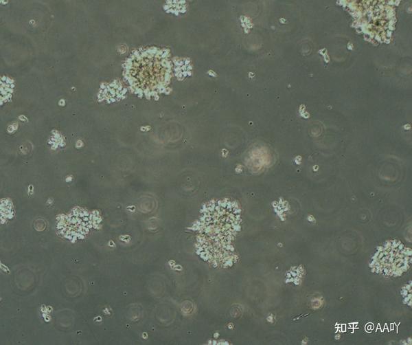 细胞学堂｜NK-92&NK-92/MI细胞培养（转载） - 知乎