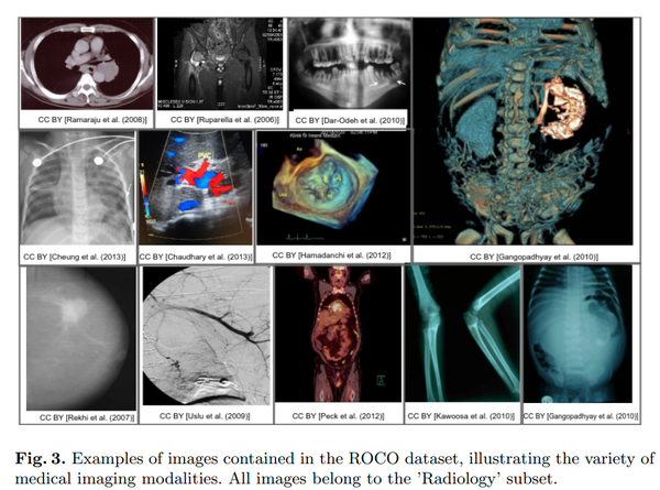 ROCOV2 数据集介绍 - 知乎
