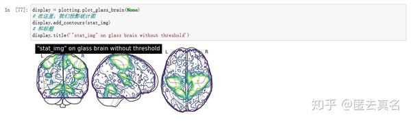 nilearn 笔记（6） - 知乎