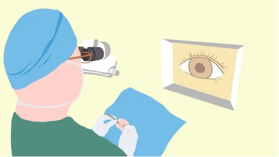 高度近视手术，PRL晶体植入术与ICL哪个更好？ - 知乎