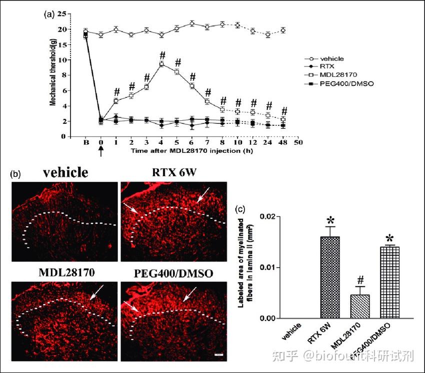 MDL 28170；钙蛋白酶和组织蛋白酶B抑制剂 - 知乎