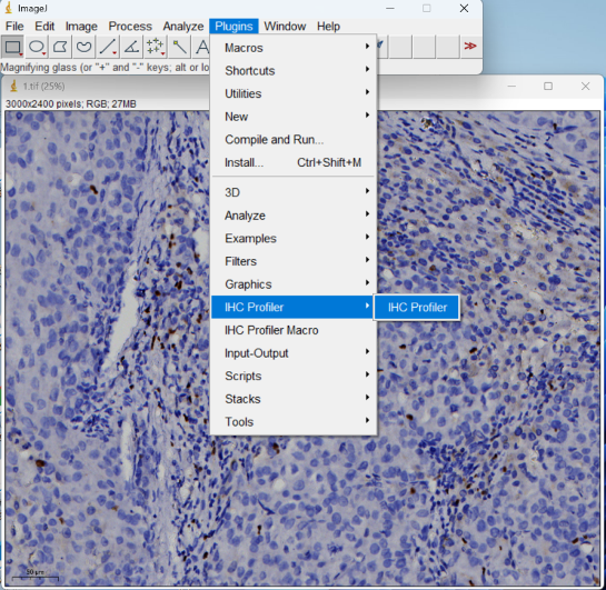 解忧小工具｜保姆式教程！用Image J进行免疫组化分析（IHC score评分） - 知乎