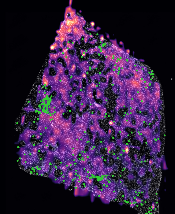 Science | 肿瘤代谢物D-2HG削弱附近的免疫细胞 - 知乎