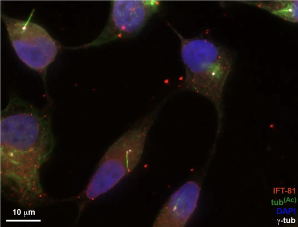 使用免疫荧光染色和MATLAB分析定量测定初级纤毛蛋白分布 - 知乎