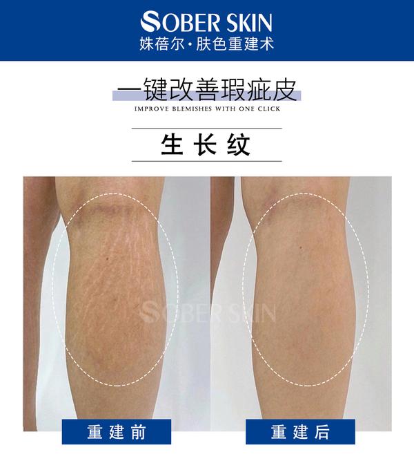 如何快速去掉生长纹? 知乎