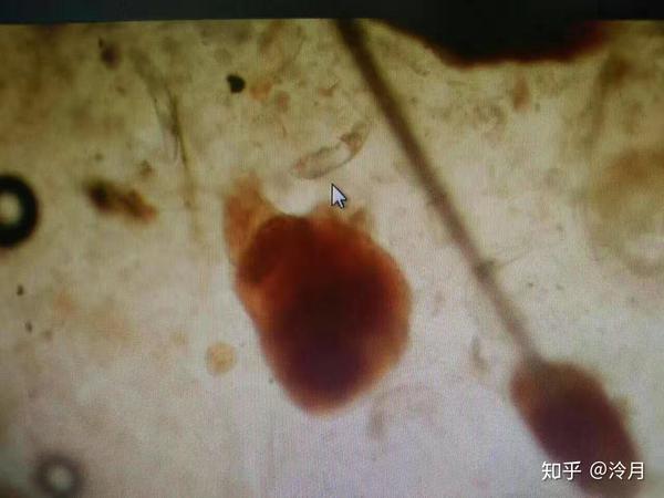 犬传染性肝炎(CAV) - 知乎