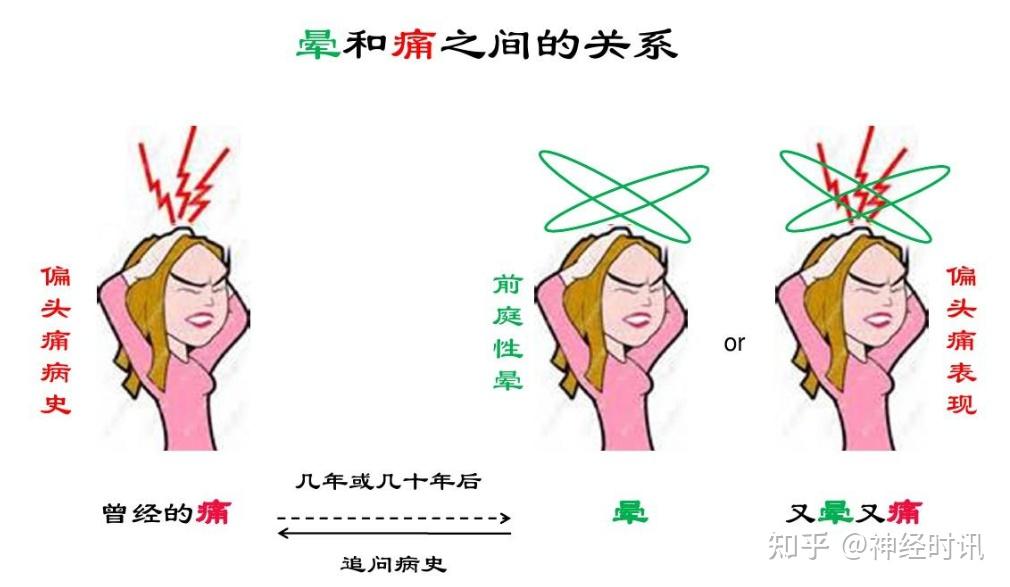 眩晕 头痛:前庭性偏头痛诊治困难重重?这5步帮你理清思路! 知乎